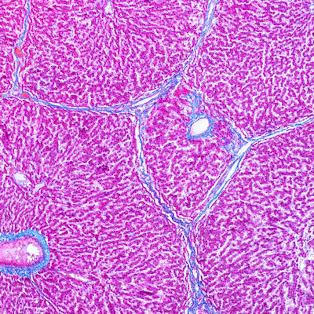 HistoQC software aims to improve digital pathology | LabPulse.com
