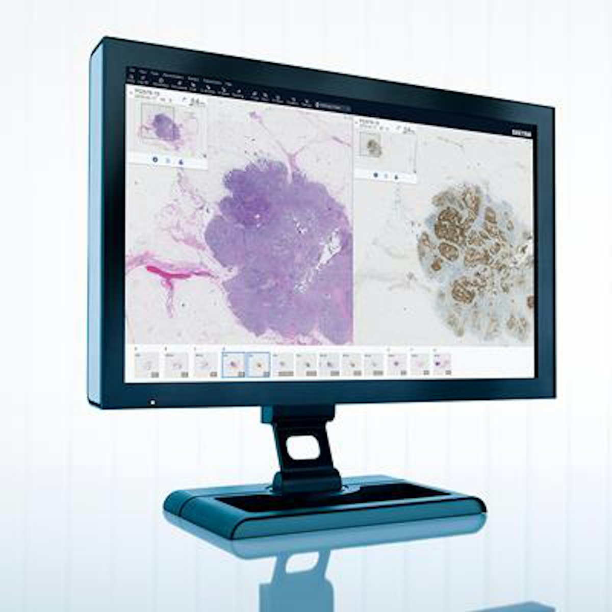Sectra gets FDA nod for digital pathology module | LabPulse.com