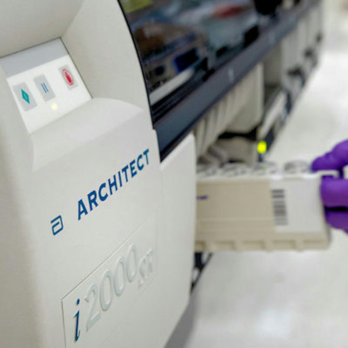 Abbott unveils lab-based COVID-19 antibody blood test | LabPulse.com