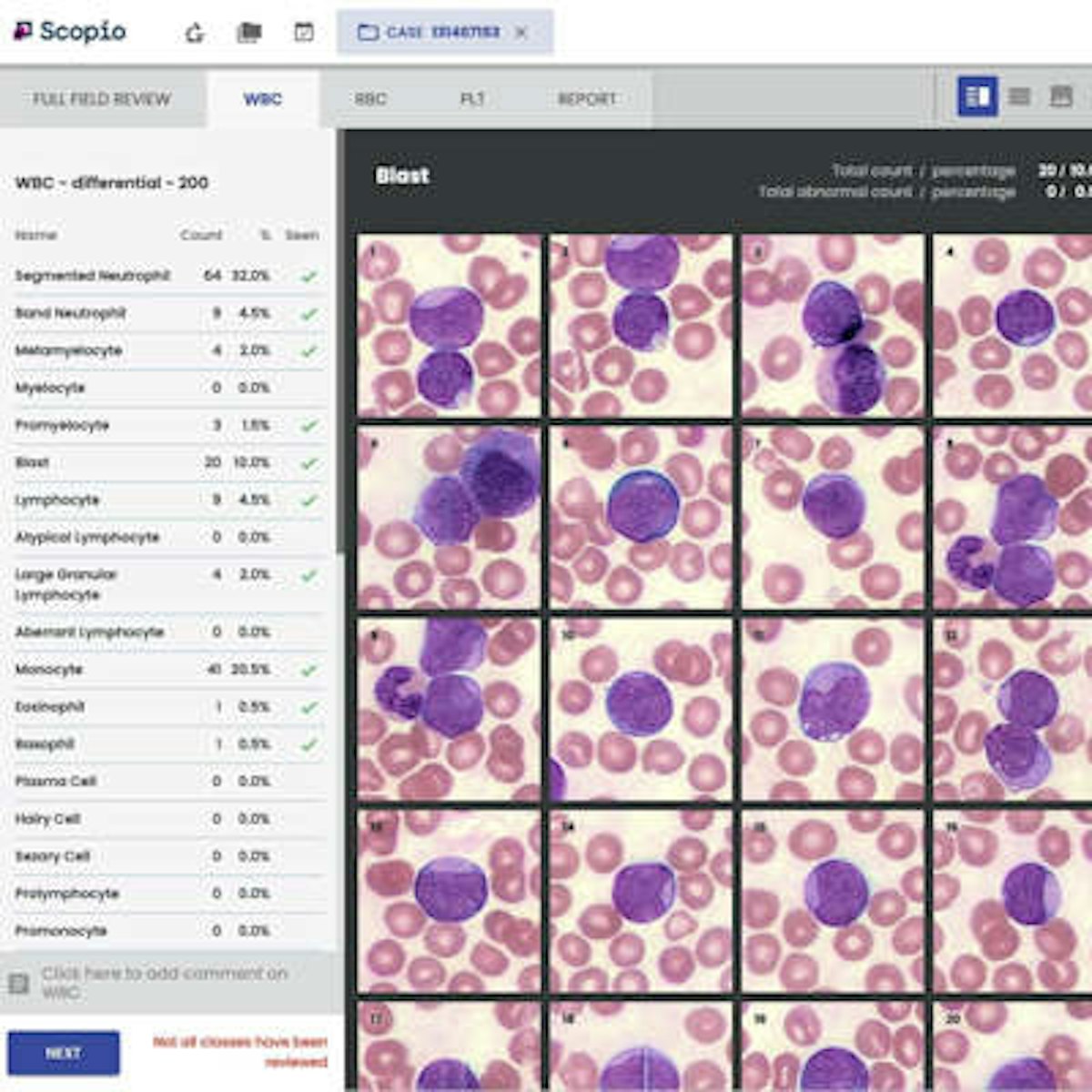 Scopio introduces full-field PBS application | LabPulse.com