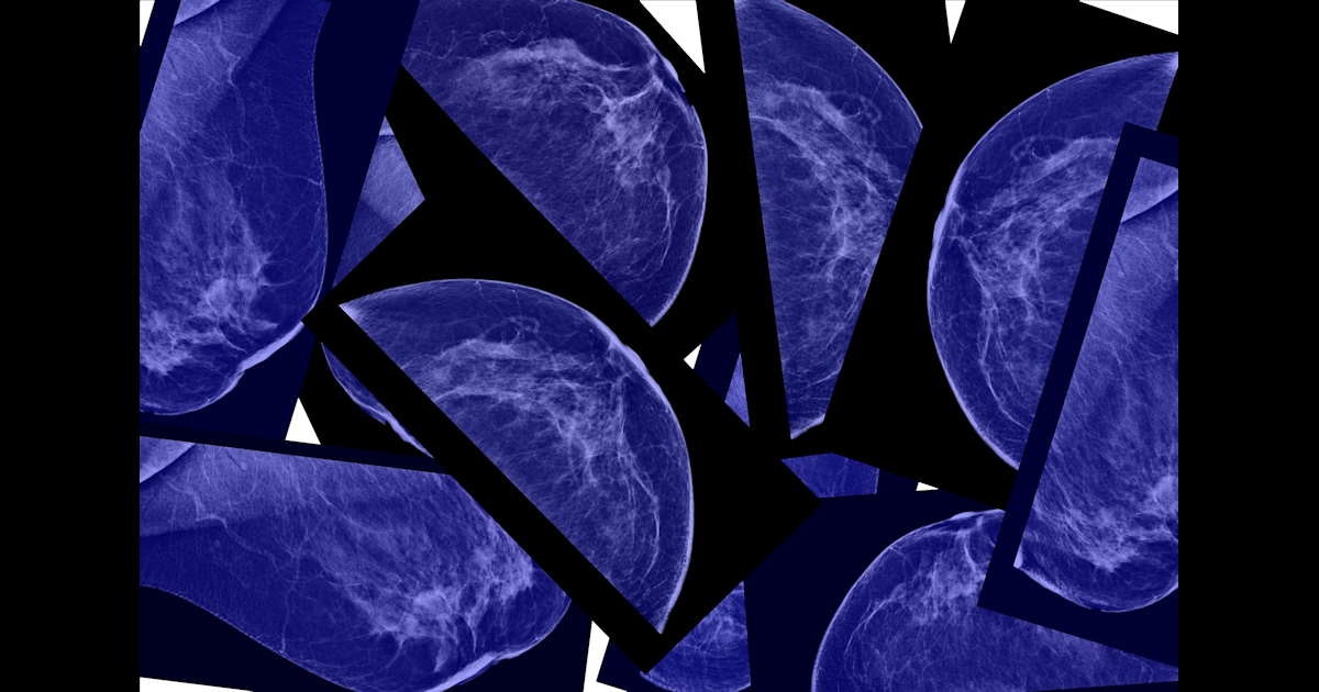 University of Eastern Finland researchers develop algorithm for better ...